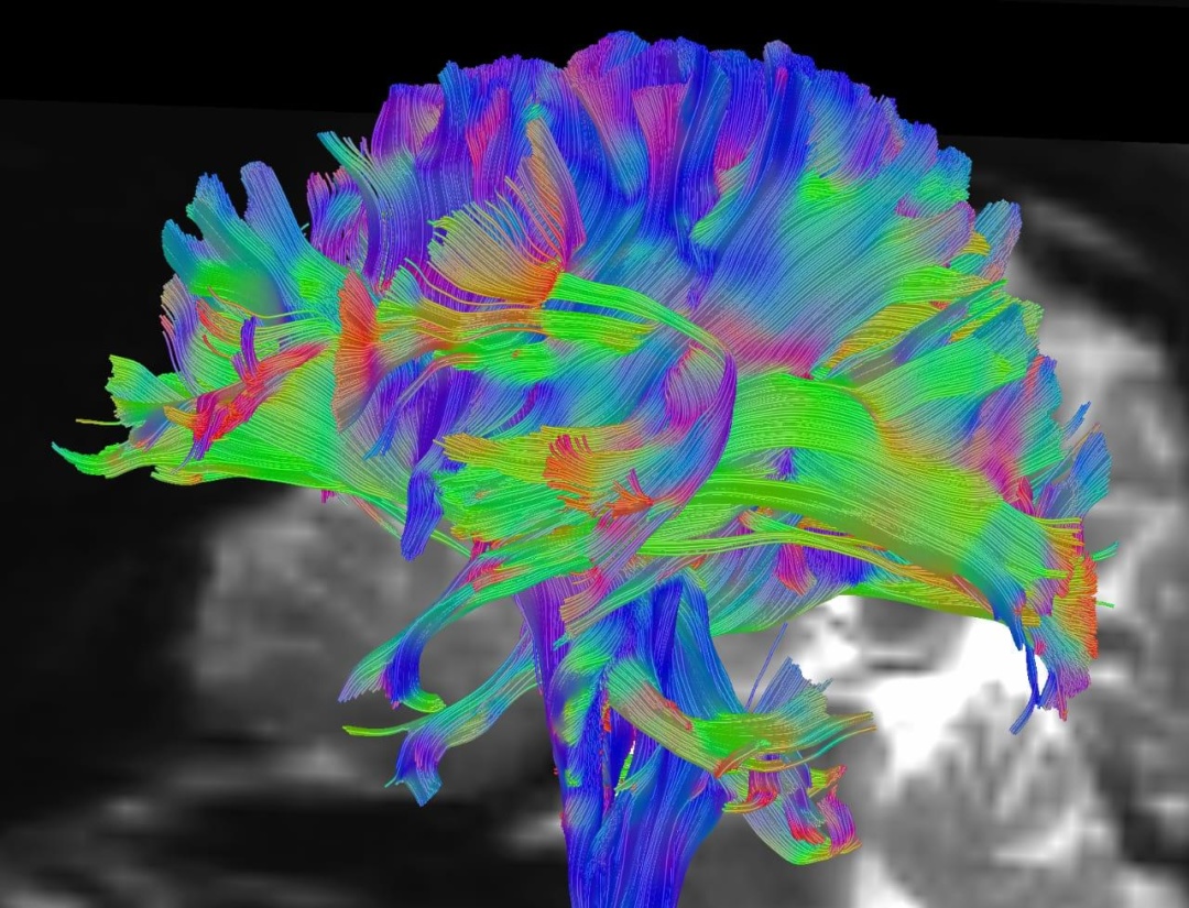 Feofaniya hospital introduces unique brain scan to detect sleep and ...