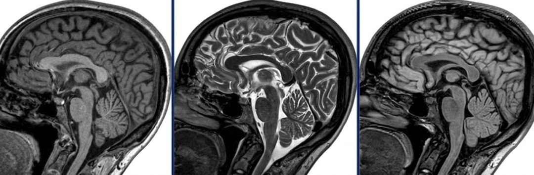 Feofaniya hospital introduces unique brain scan to detect sleep and ...
